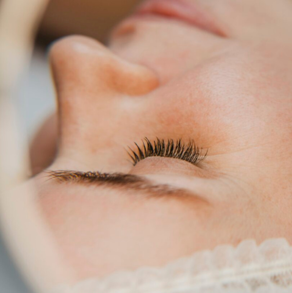Byonik pulse triggered laser skin facial treatment clinic Sheffield